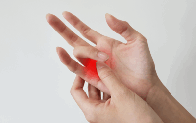 Trigger Finger Steroid Injection Guide